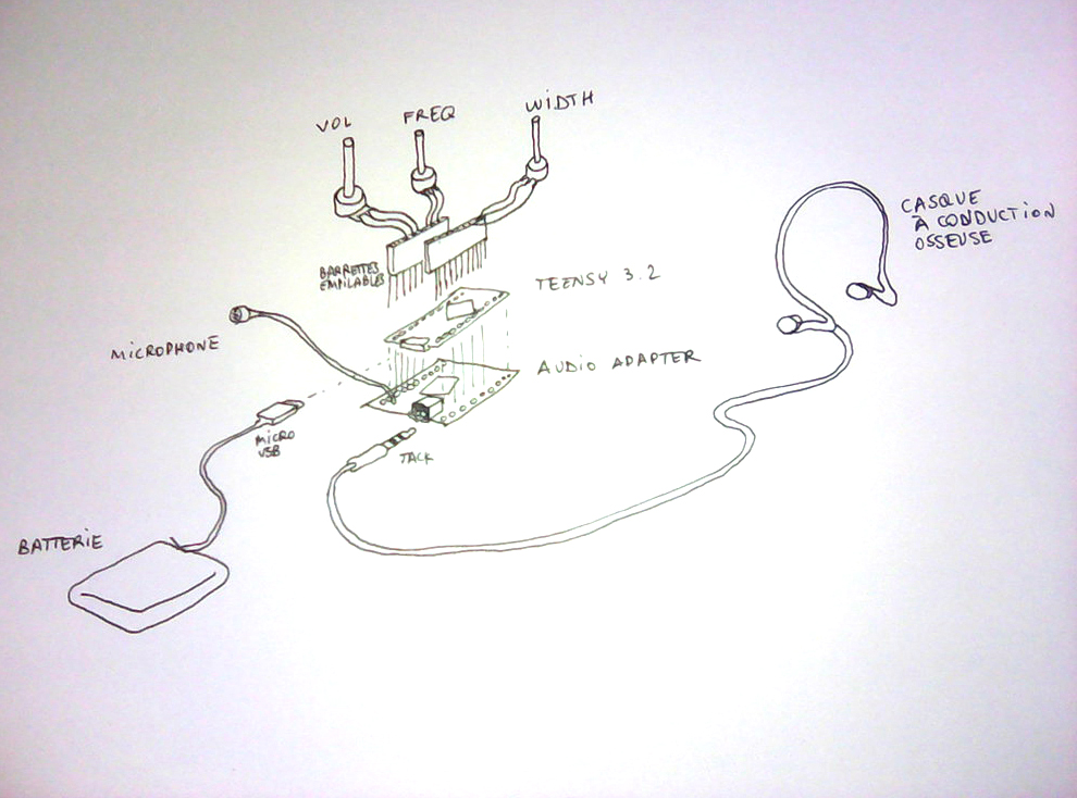 Casque à conduction osseuse : il vous change la vie
